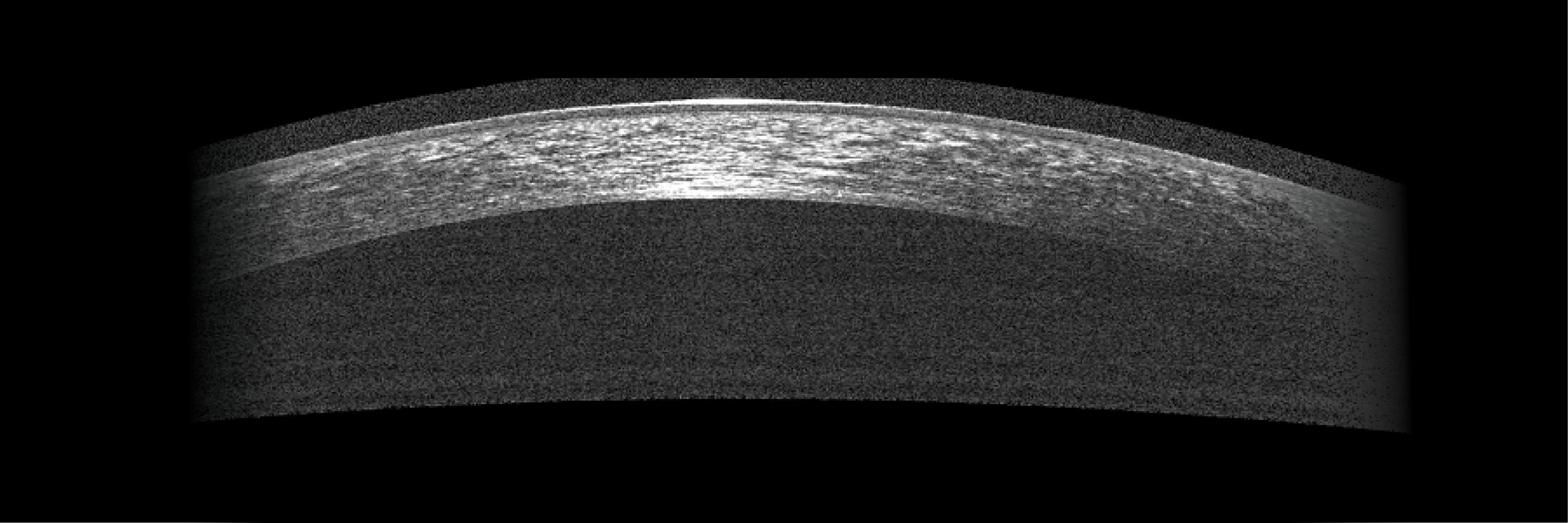 Ocular coherence tomography (OCT) | Spectacle Warehouse