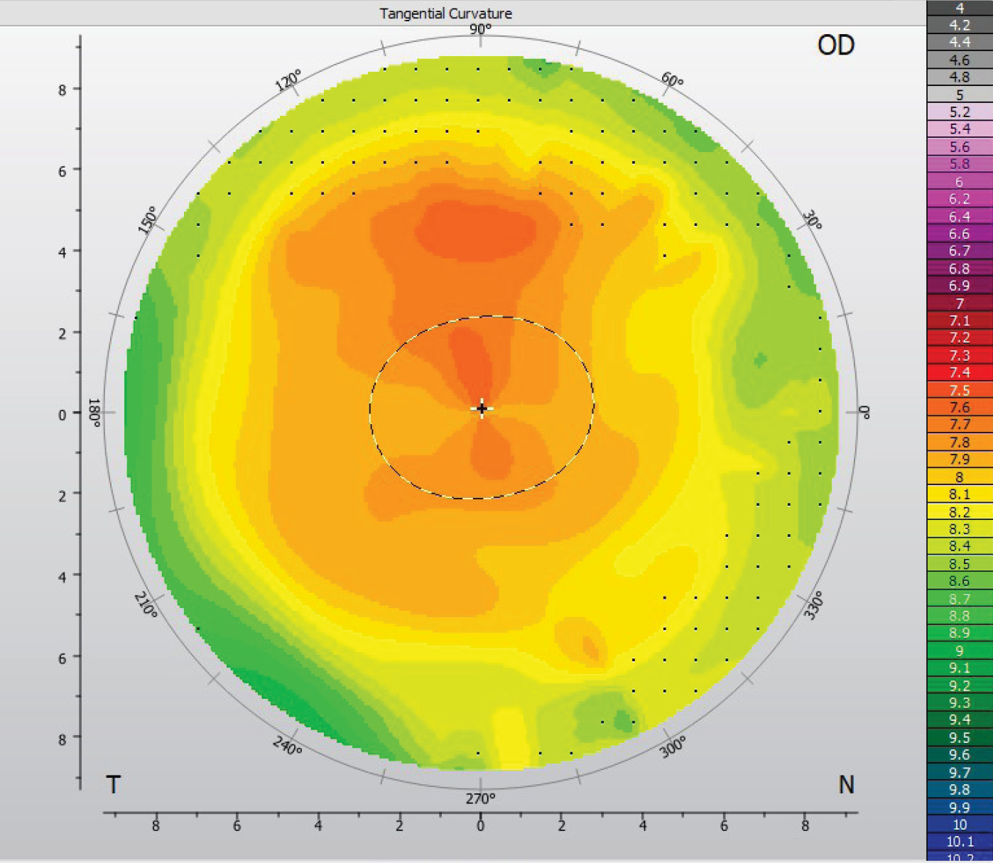 eyecare | Spectacle Warehouse